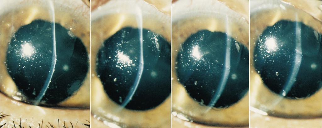 On Focusing The Slit-Lamp: Part I. An Inaccurate Ocular Setting-What Is ...